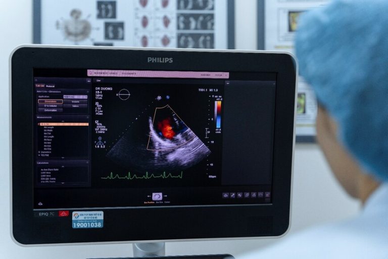 KỸ THUẬT SIÊU ÂM DOPPLER TIM: PHÁT HIỆN SỚM – ĐIỀU TRỊ ĐÚNG – BẢO VỆ ...
